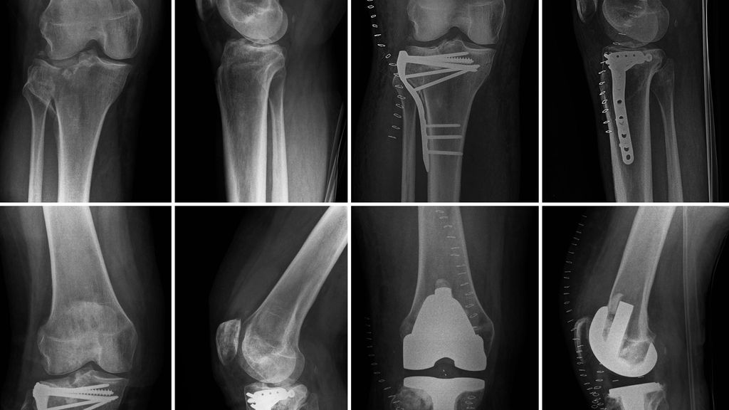 Therapeutischer Ultraschall - Orthopädie & Traumatologie - Universimed ...