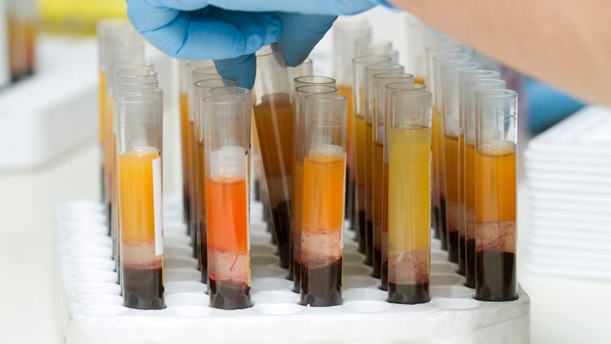 Serologie: Grenzen einer Methode - Infektiologie - Universimed ...