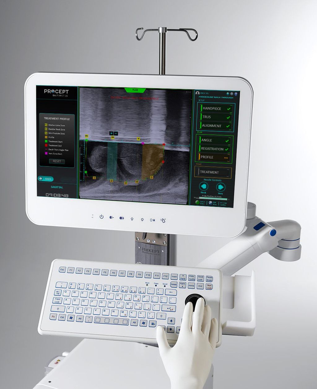 Ersetzt die Aquablation der Prostata bald die TUR-P? - Urologie ...