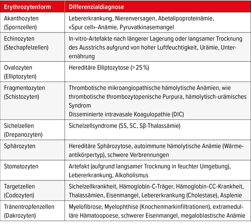 Interpretation des mikroskopischen Blutbildes - Allgemeine Innere ...