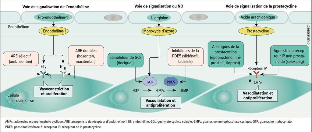 HTAP: le traitement standard est le traitement en association initial ...