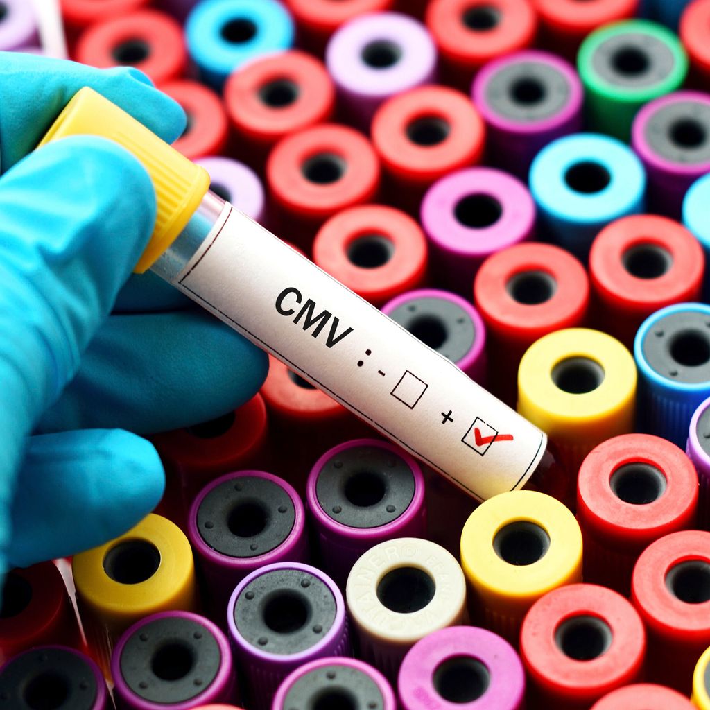 CMV – Virologie und Bedeutung bei Immunsuppression - Infektiologie ...