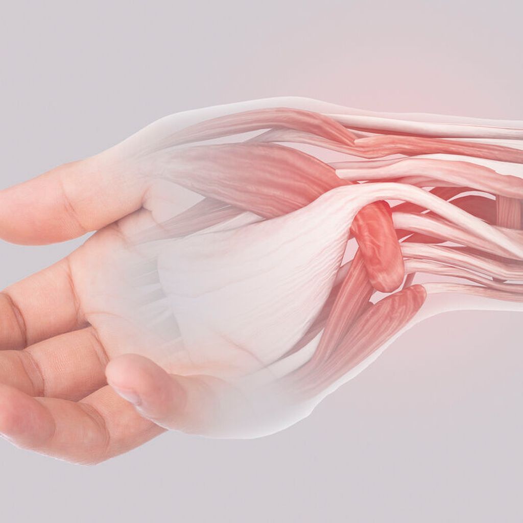 Nervenkompressionssyndrome an der oberen Extremität - Orthopädie ...