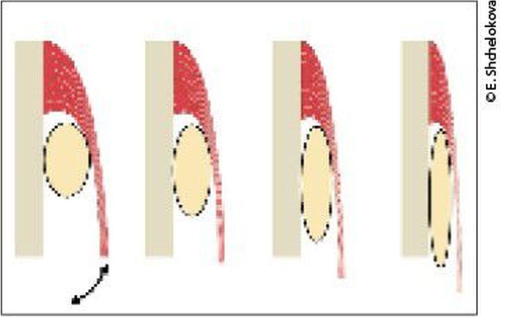 Smart cosmetology: a new approach to facial rejuvenation - Plastische ...