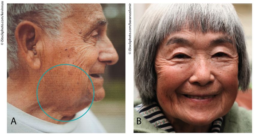 Smart cosmetology: a new approach to facial rejuvenation - Plastische ...