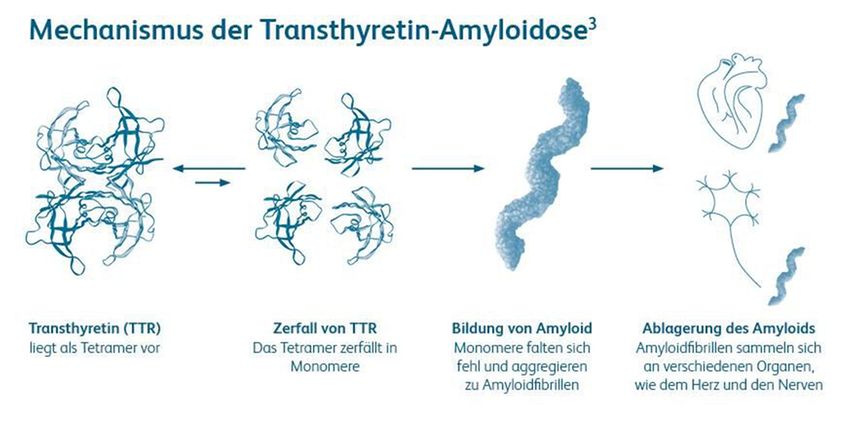 Tafamidis zur Behandlung der kardialen Transthyretin-Amyloidose - Kardiologie & Gefässmedizin ...
