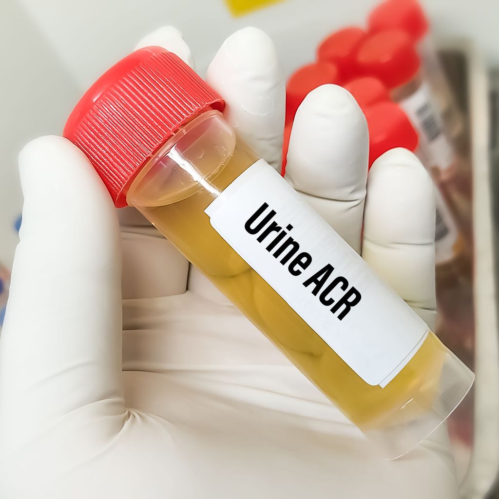 Diabète et reins - Contenu en francais - Universimed - Medizin im Fokus