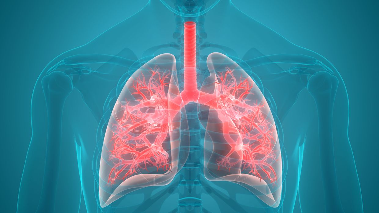 Die obere Einflussstauung – wie kann man intervenieren? - Pneumologie ...