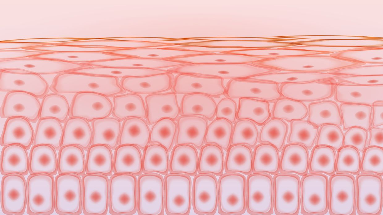 Standardisierte Beurteilung chronischer Wunden - Dermatologie ...