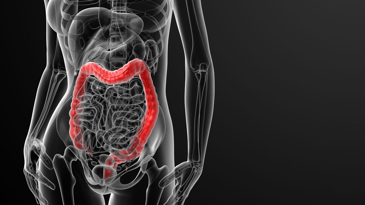 Was ist „State of the Art“ in der adjuvanten Therapie des Kolonkarzino ...