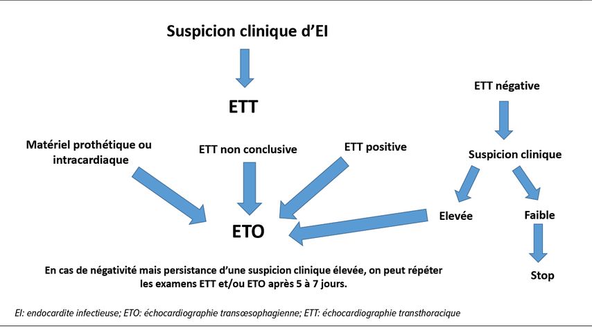 Endocardite infectieuse: pathologie redoutable avec diagnostic diffici ...