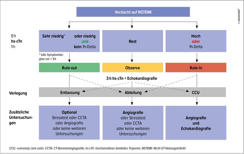 Der hs-cTn-0/1h-Algorithmus zur raschen Diagnostik des Myokardinfarkts ...