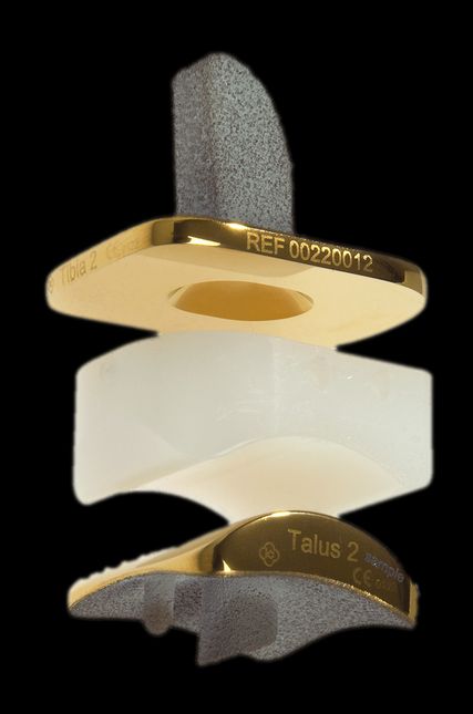 Entwicklung und aktueller Stand der OSG-Prothese - Orthopädie ...