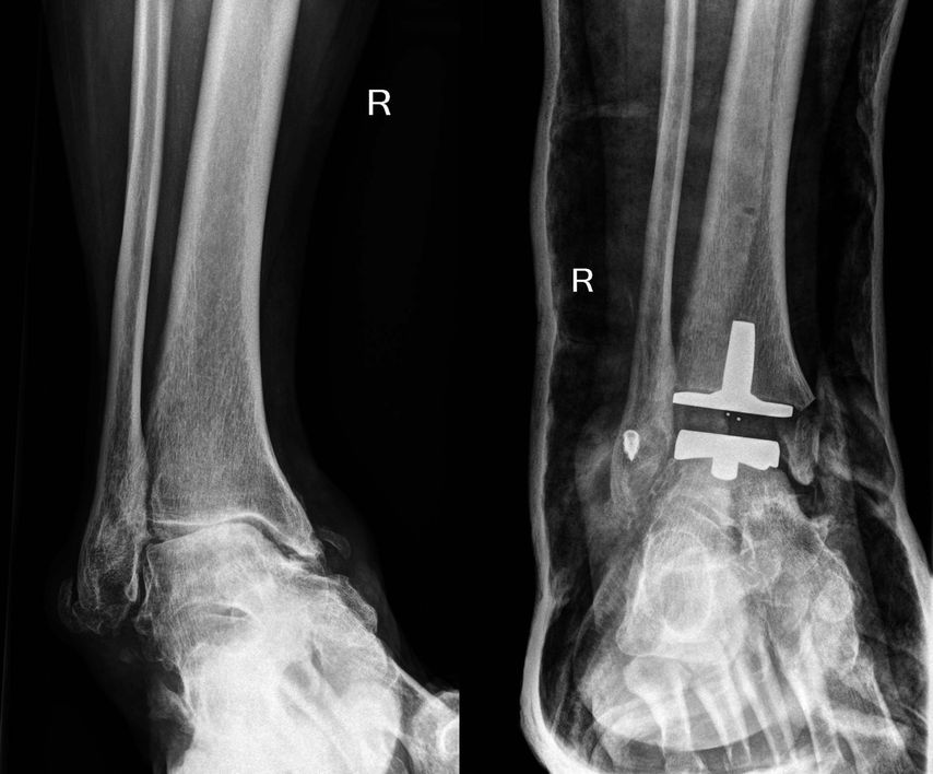 Es ist nicht alles Arthrose - Orthopädie & Traumatologie - Universimed ...