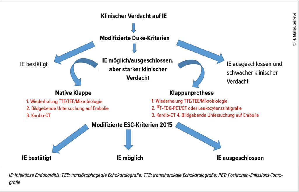 Endocardite infectieuse: pathologie redoutable avec diagnostic diffici ...