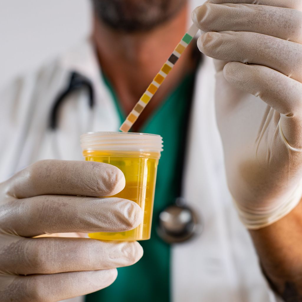 Infektionen und unterer Harntrakt - Urologie & Andrologie - Universimed ...