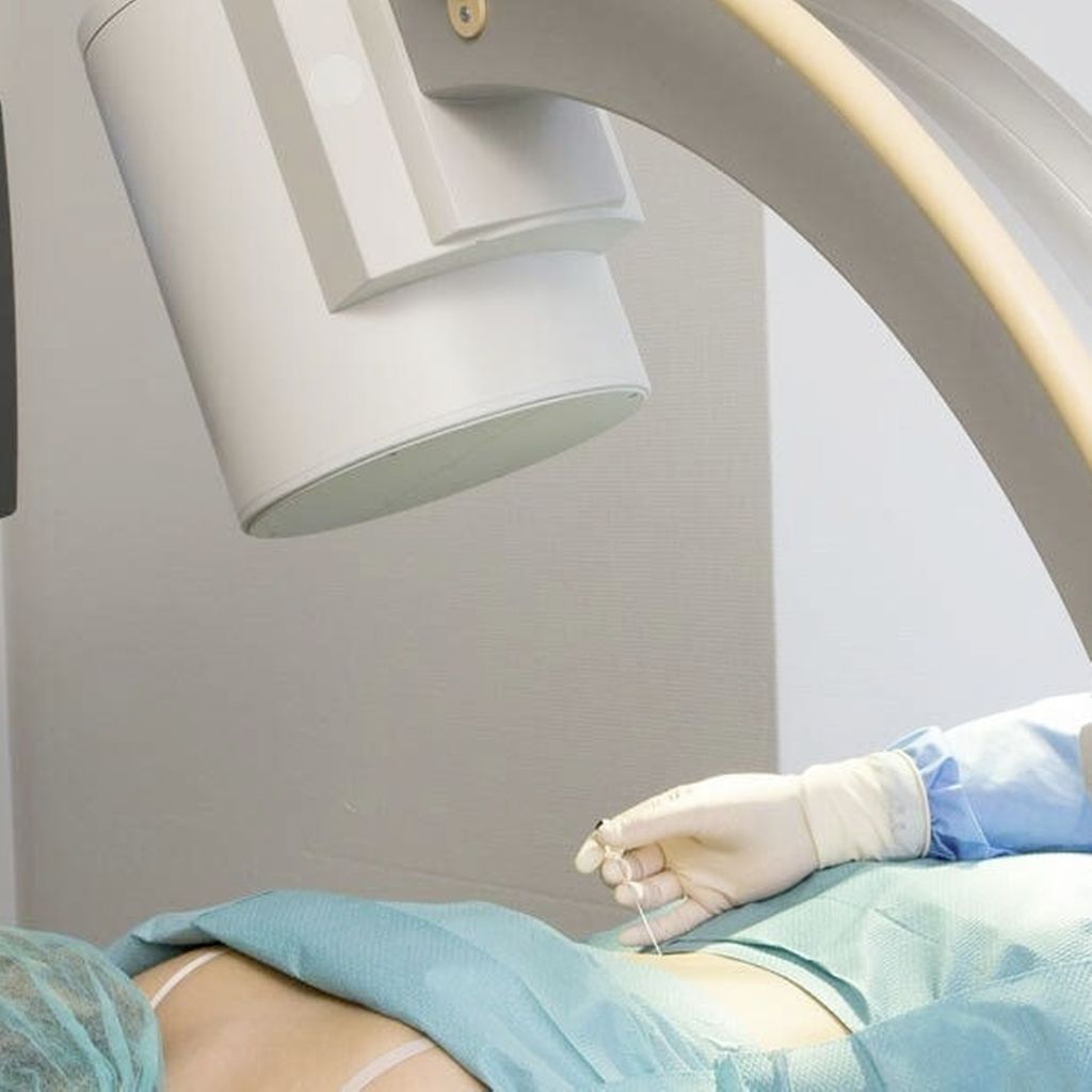 Leitlinie zur Radiofrequenzdenervation bei Kreuzschmerz erschienen ...