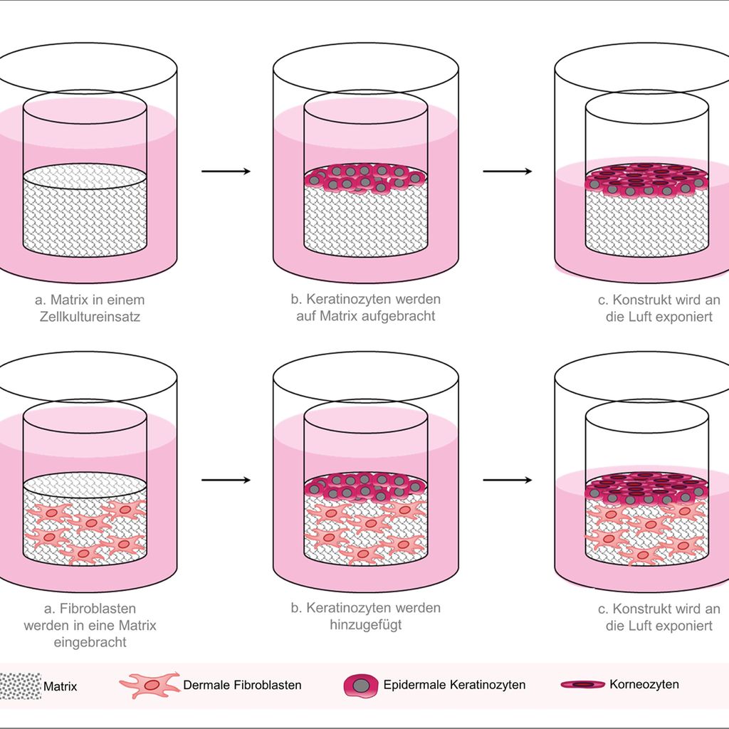 Dreidimensionale In-vitro-Modelle für humane Haut - Plastische ...