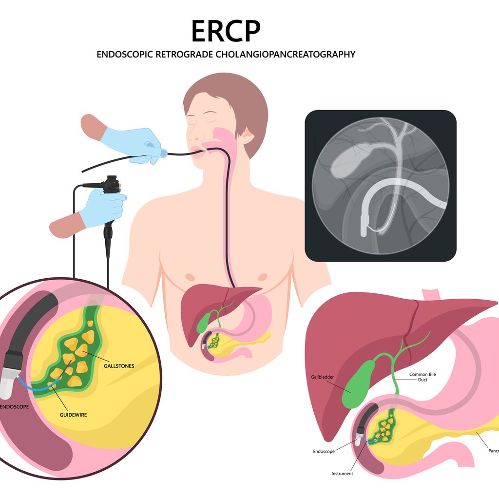 Maladies des voies biliaires et du pancréas – démarche diagnostique et - Contenu en francais ...