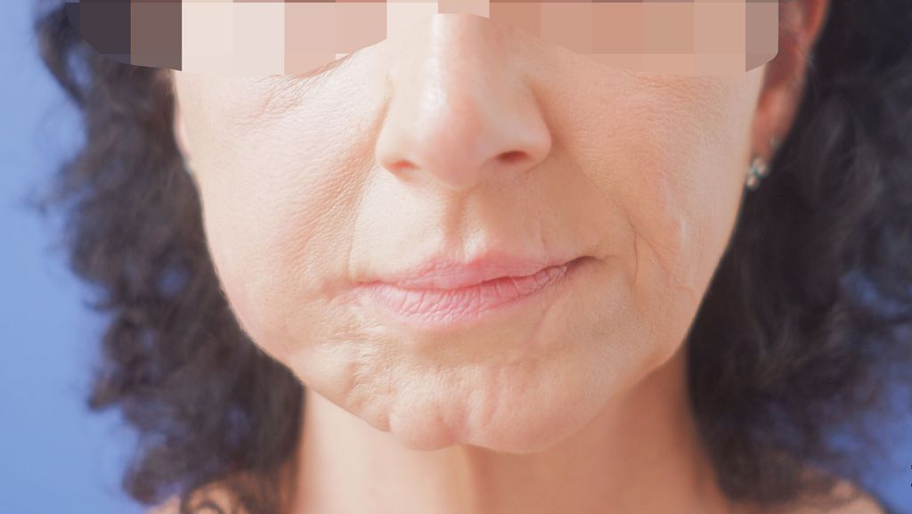 Nouvelle procédure de reconstruction du visage et de traitement des ...