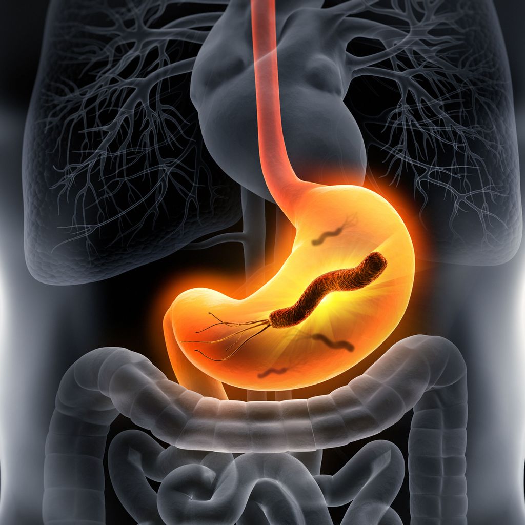 Helicobacter pylori: Was bleibt, was ändert sich? - Gastroenterologie ...