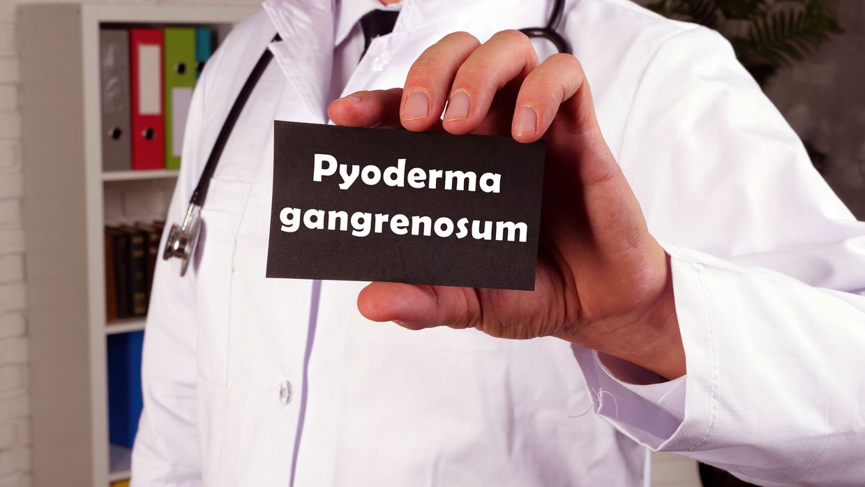 Pyoderma gangraenosum: Algorithmen für den klinischen Alltag ...
