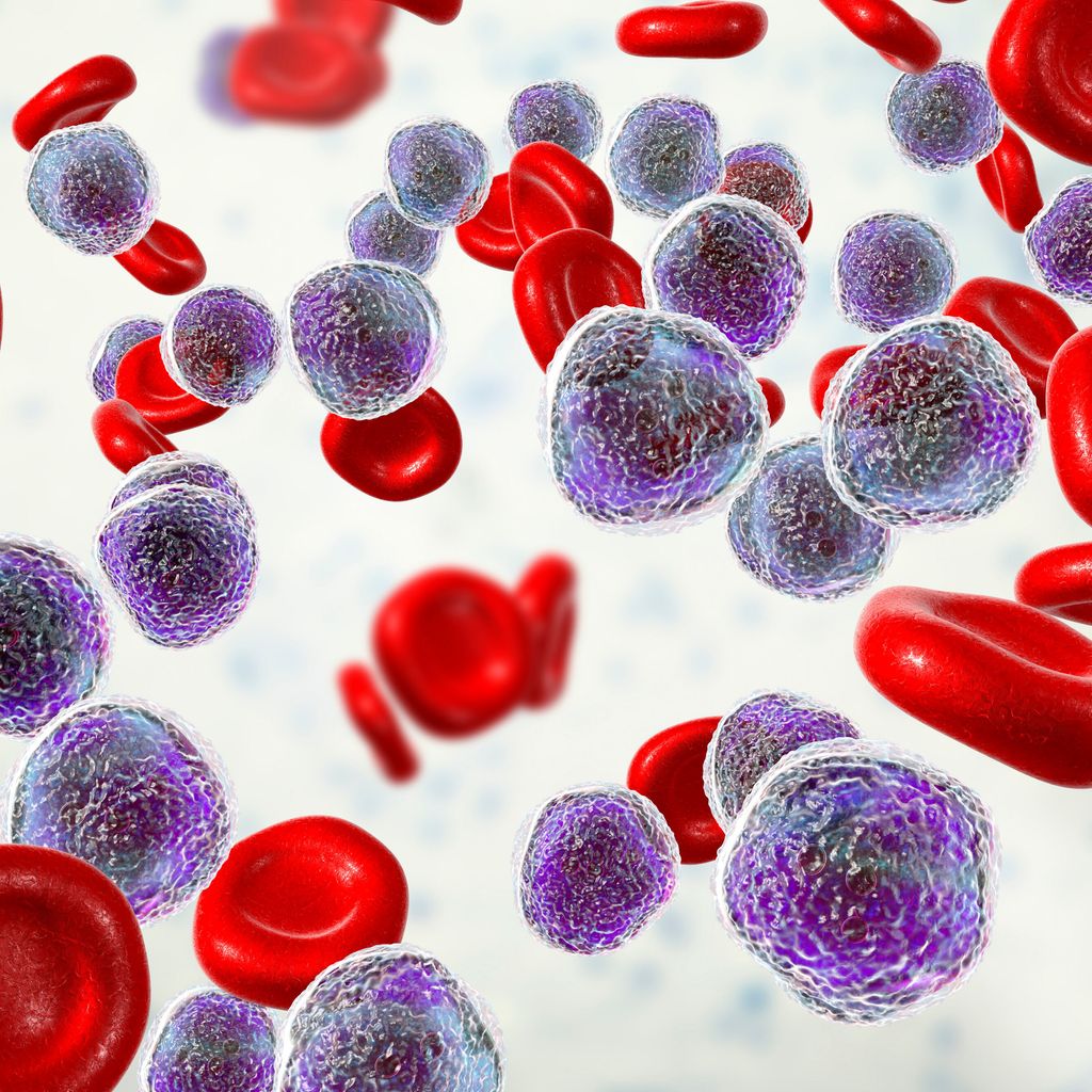 Revumenib ist neue Therapieoption bei KMT2Ar akuter Leukämie ...