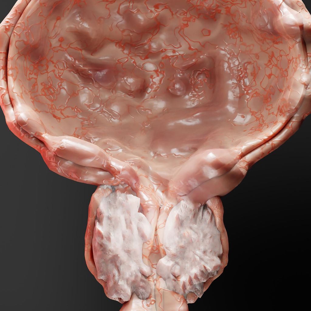 Erfahrungen mit TULEP im Salzkammergut Klinikum Vöcklabruck - Urologie ...