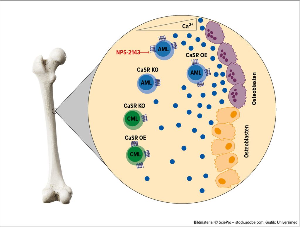 Das chemische Milieu im Knochenmark und sein therapeutischer Nutzen ...
