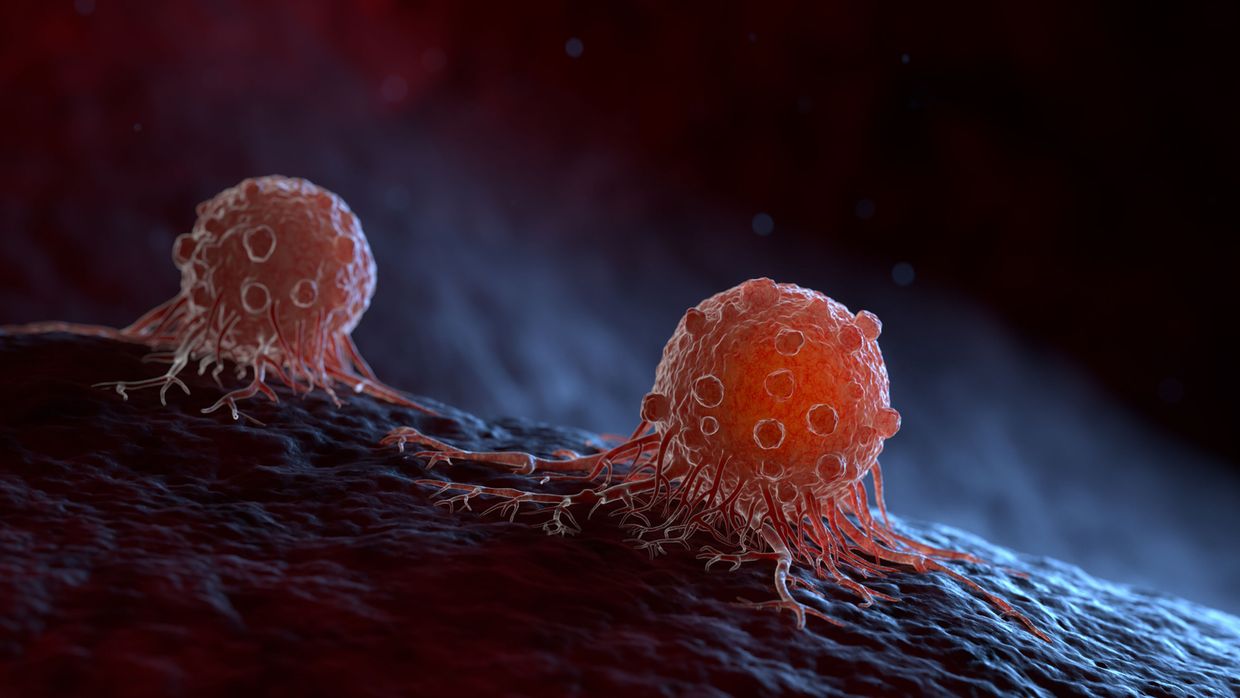 Das metaplastische Mammakarzinom - Onkologie - Universimed - Medizin im ...