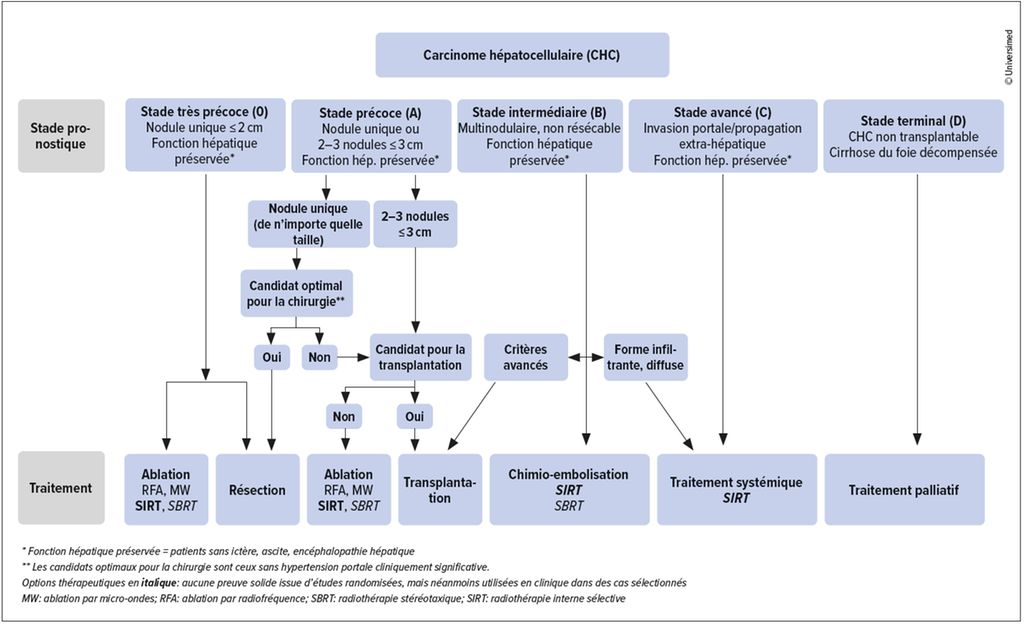 Carcinome hépatocellulaire - Universimed - Medizin im Fokus