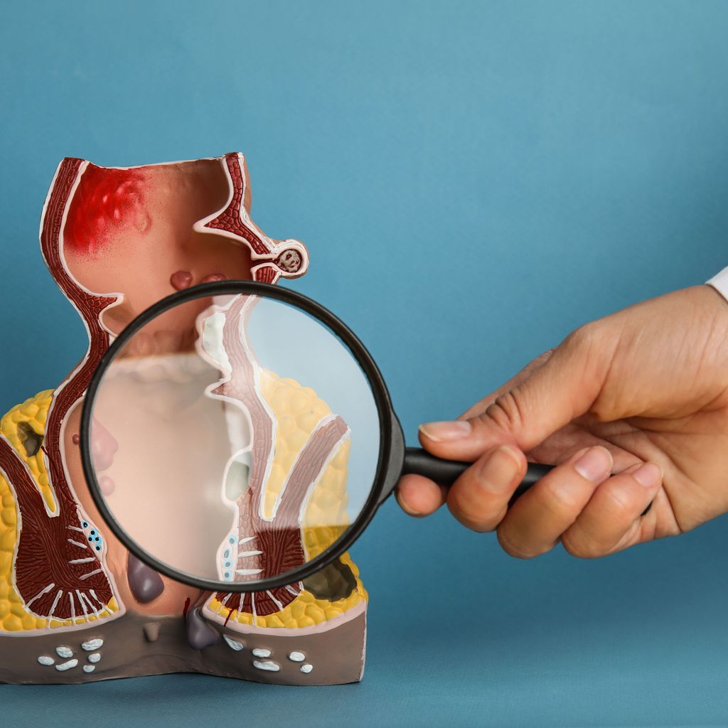 Die proktologische Basisuntersuchung - Gastroenterologie - Universimed ...