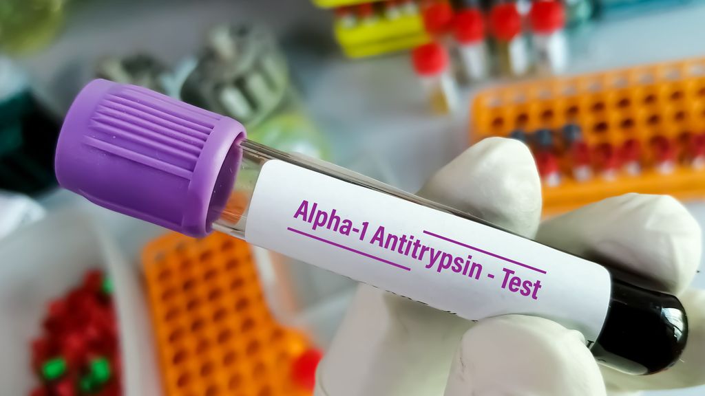 Wann Progesterontherapie und wann Zervixcerclage? - Gynäkologie ...