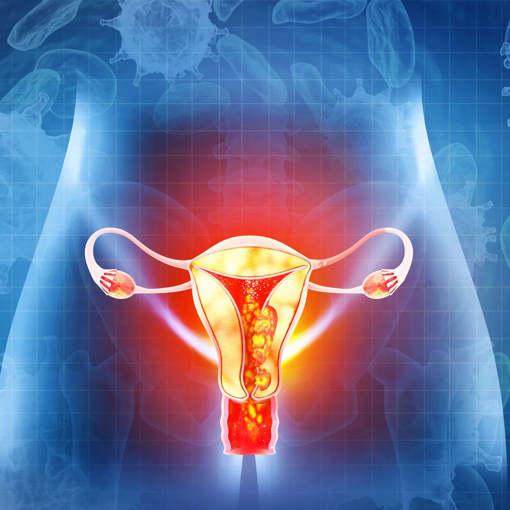 Lymph node assessment in endometrial cancer - Gynäkologie ... Lymph node assessment in endometrial cancer - Gynäkologie ...