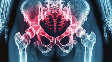 Die Akromionfraktur - Orthopädie & Traumatologie - Universimed ...