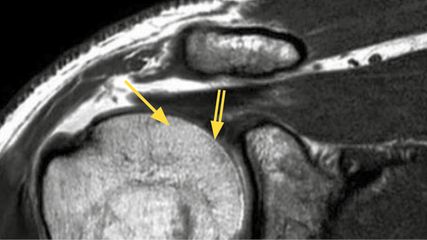 Die OSG-Distorsion: häufig und häufig unterschätzt - Orthopädie ...