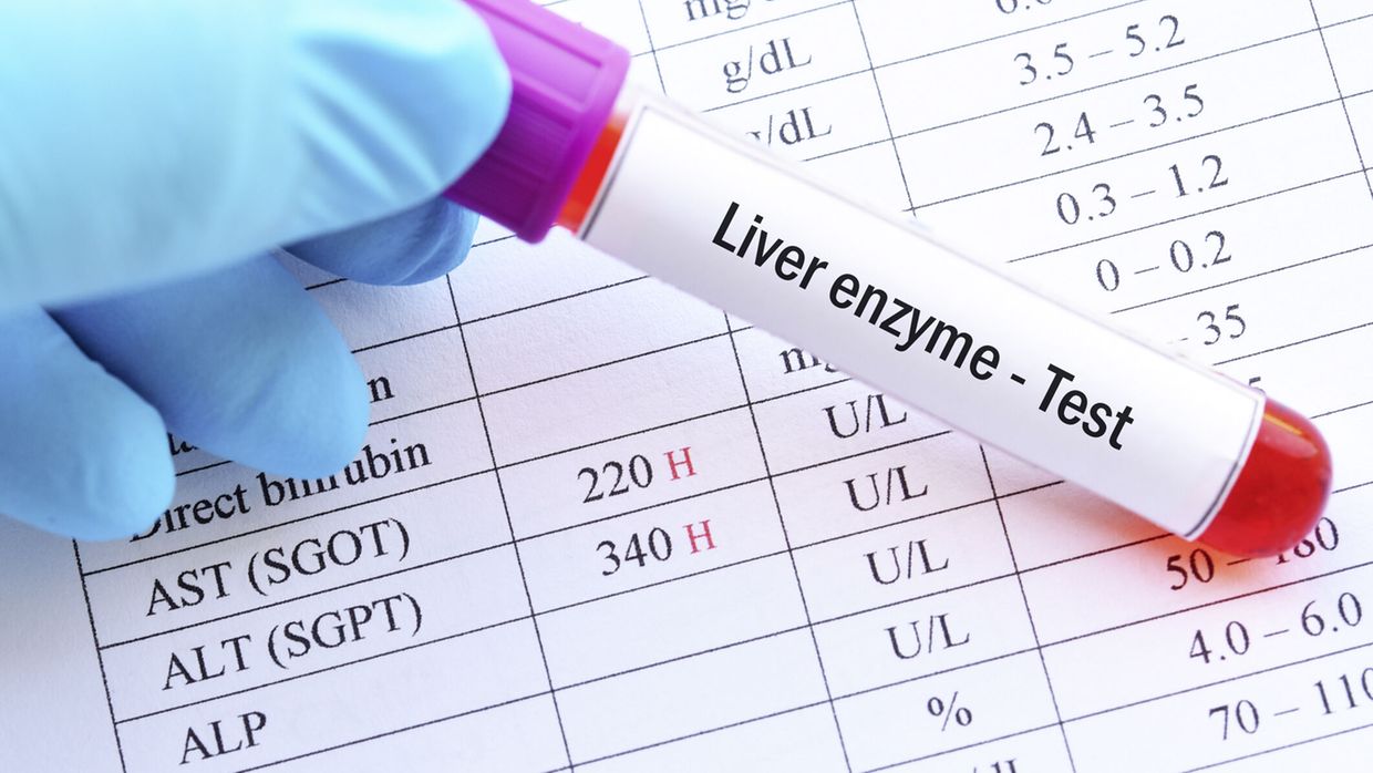 Transaminasen, Cholestasen, Ikterus: wie interpretieren? - Hepatologie ...