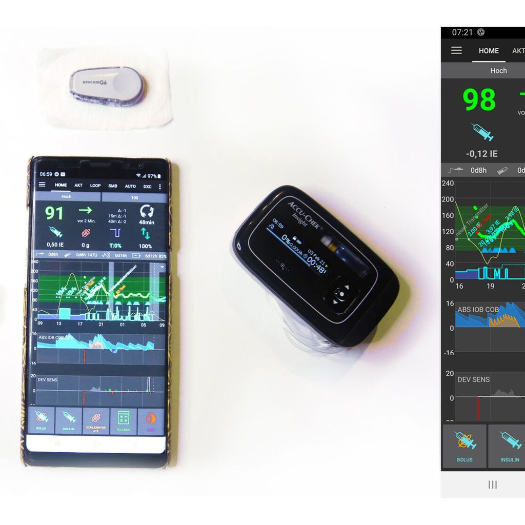 „Hybrid Closed-Loop“-Systeme – aktuelle Entwicklungen - Diabetologie ...