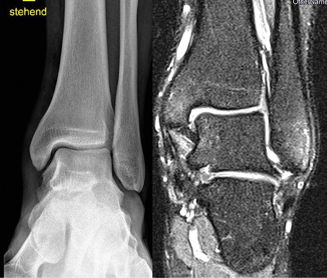 Fußquiz - Orthopädie & Traumatologie - Universimed - Knowledge that matters