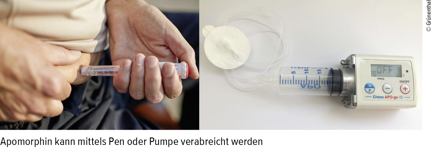 Apomorphin bei fortgeschrittenem Parkinsonsyndrom - Neurologie ...