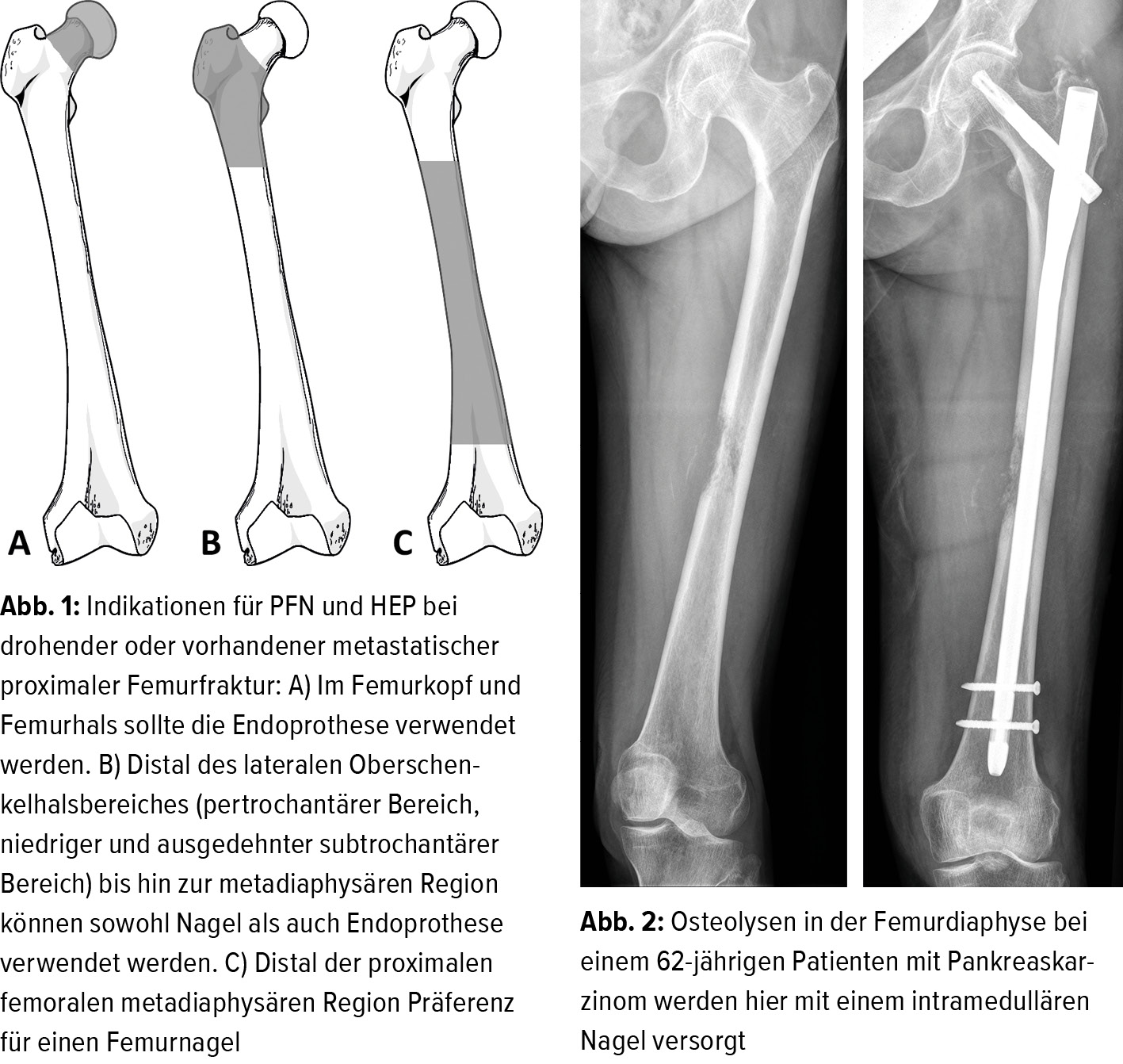 Proximalen Digitale Blockade Orientierungspunkte Und ...