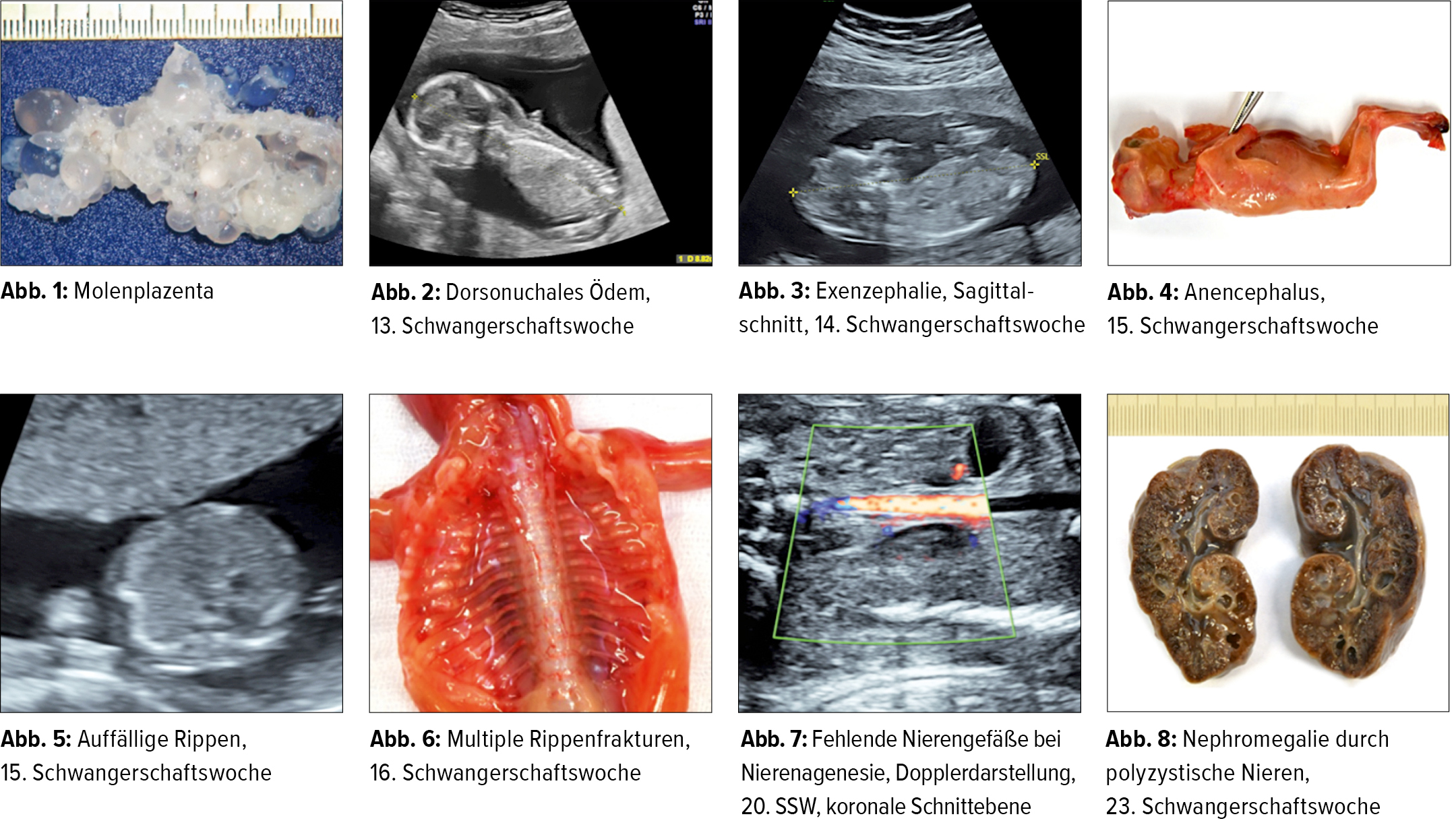 Pathologie in Schwangerschaft und Perinatalperiode - Gynäkologie ...