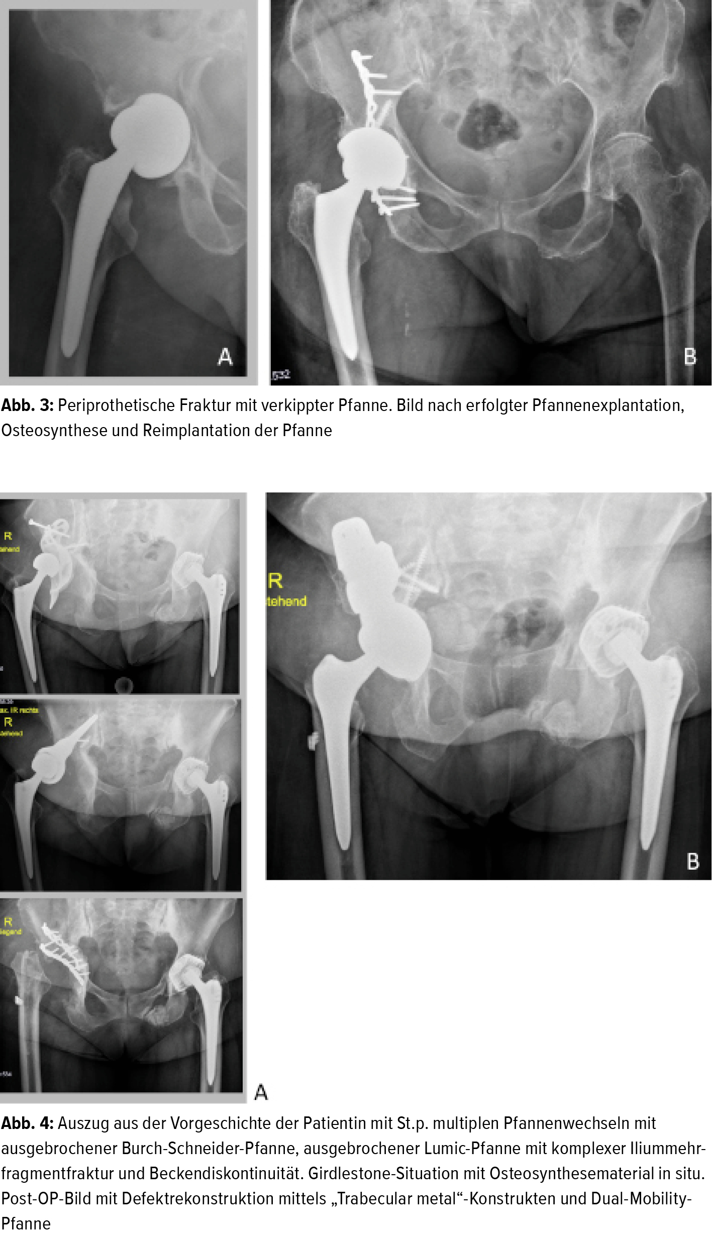 Die Rolle des dorsalen Zuganges - Orthopädie & Traumatologie ...