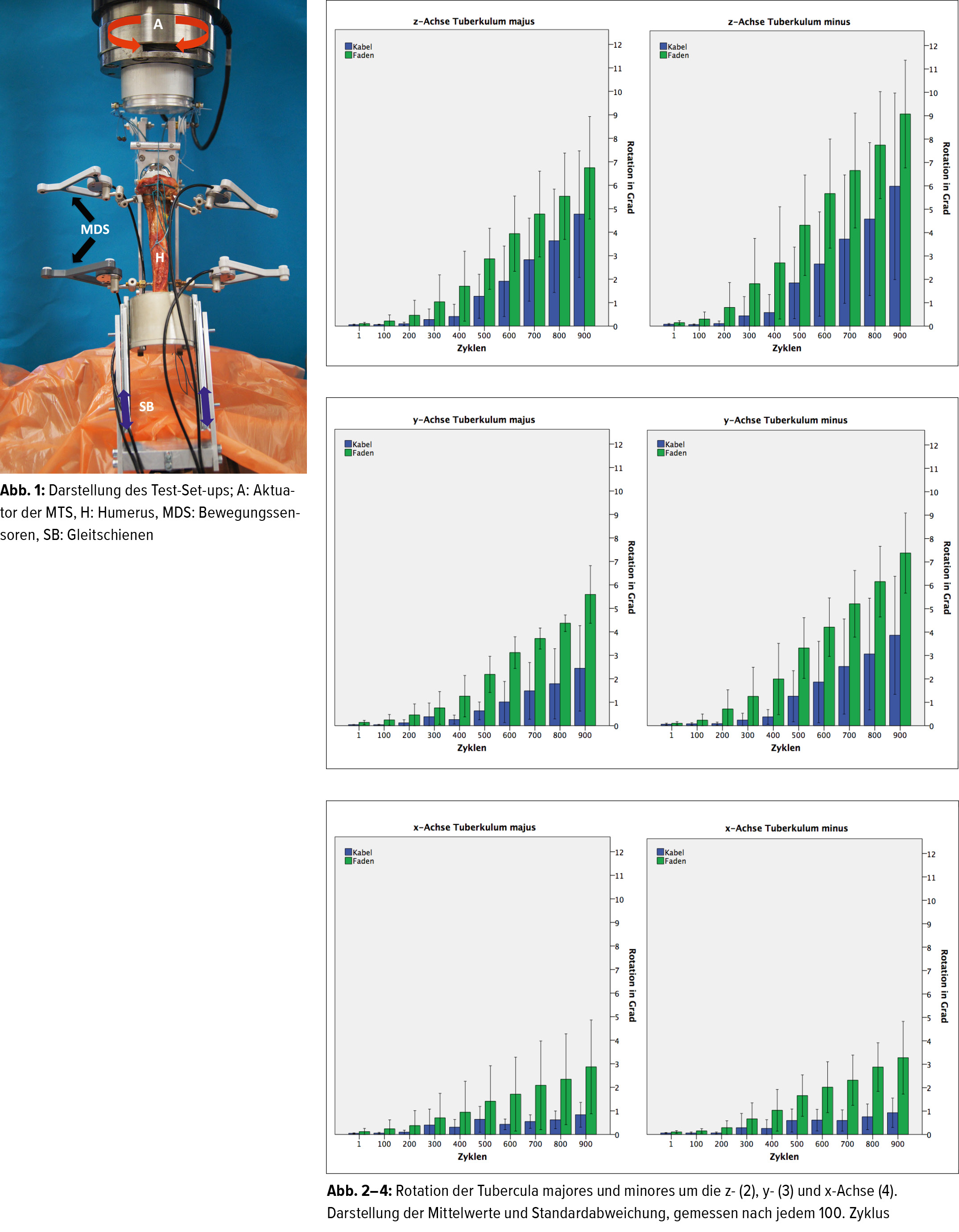 Biomechanische Untersuchung der Tubercula- Refixation mit Kabel- oder ...