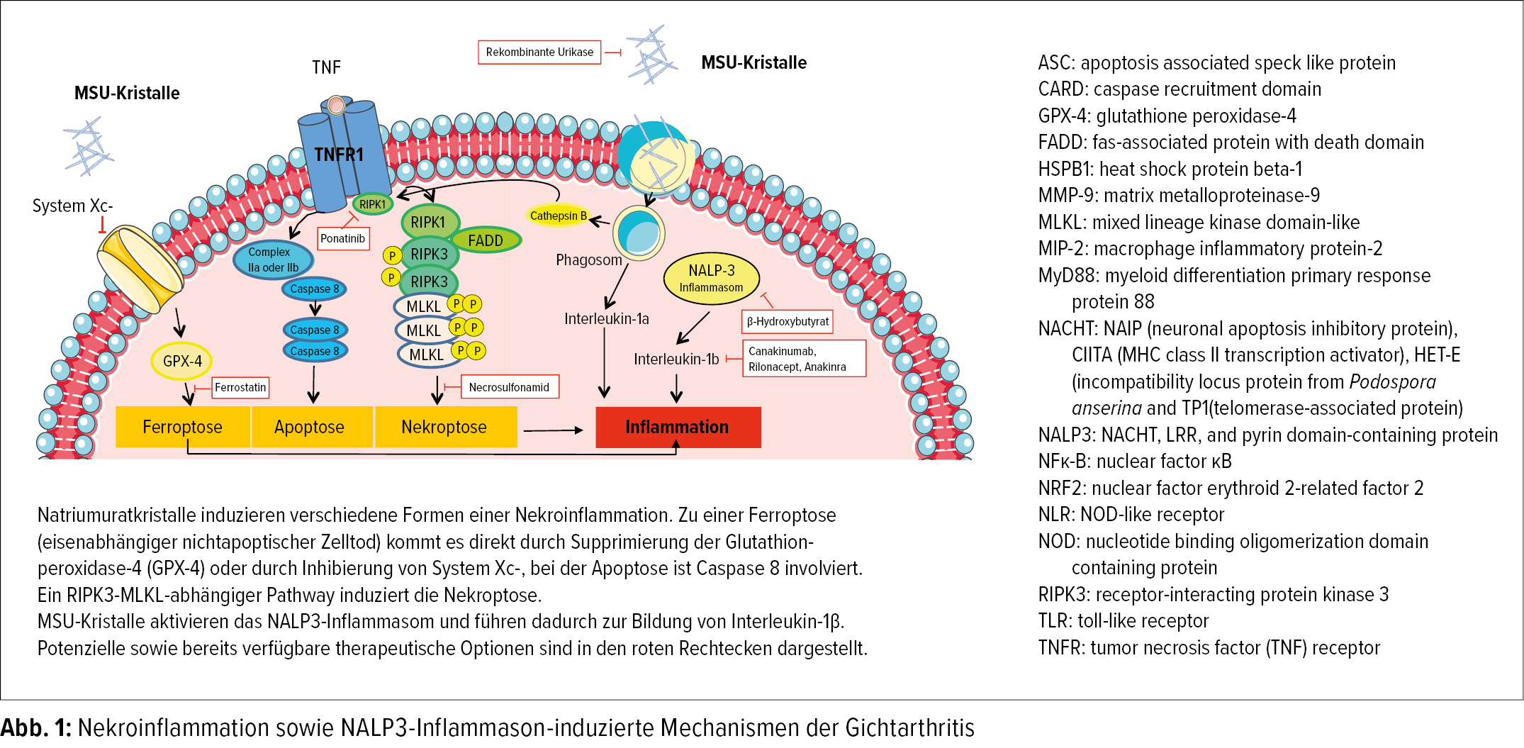 Gicht: neue Medikamente und Ernährung - Gastroenterologie - Universimed ...