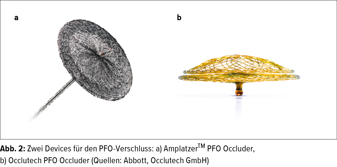ASD- und PFO-Verschluss – Update 2019 - Kardiologie & Gefäßmedizin ...
