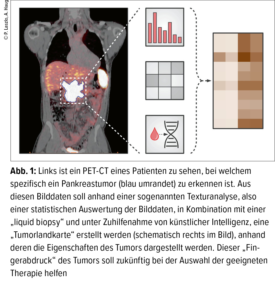 Weniger invasive Biopsien für den Krebspatienten? - Onkologie ...