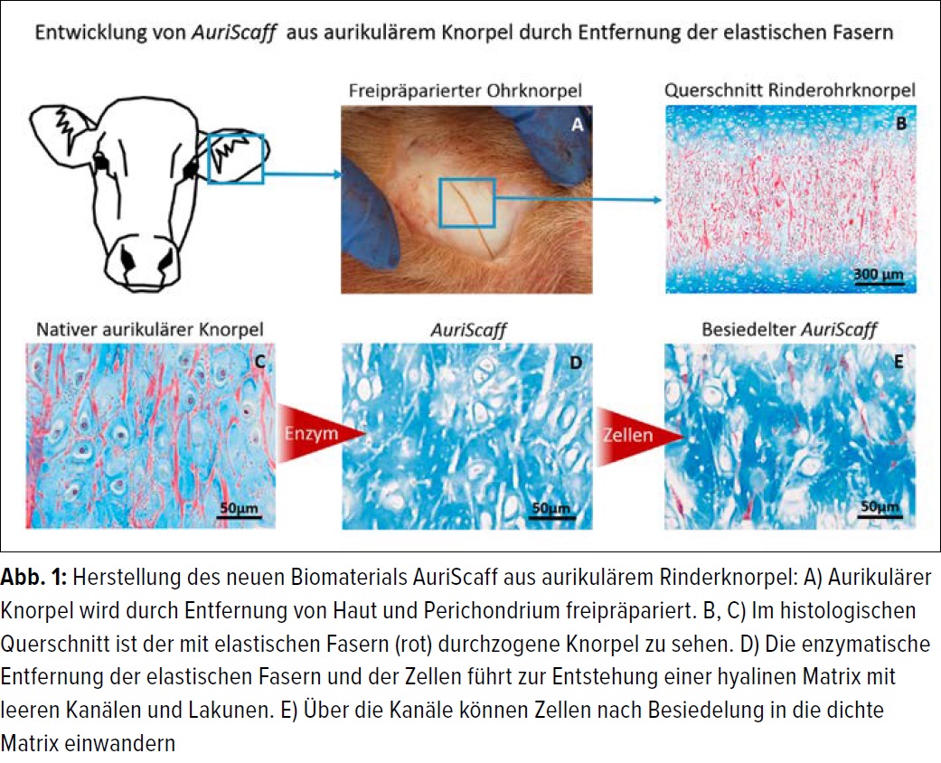 Biomimetisches Biomaterial für die Knorpelregeneration - Orthopädie ...